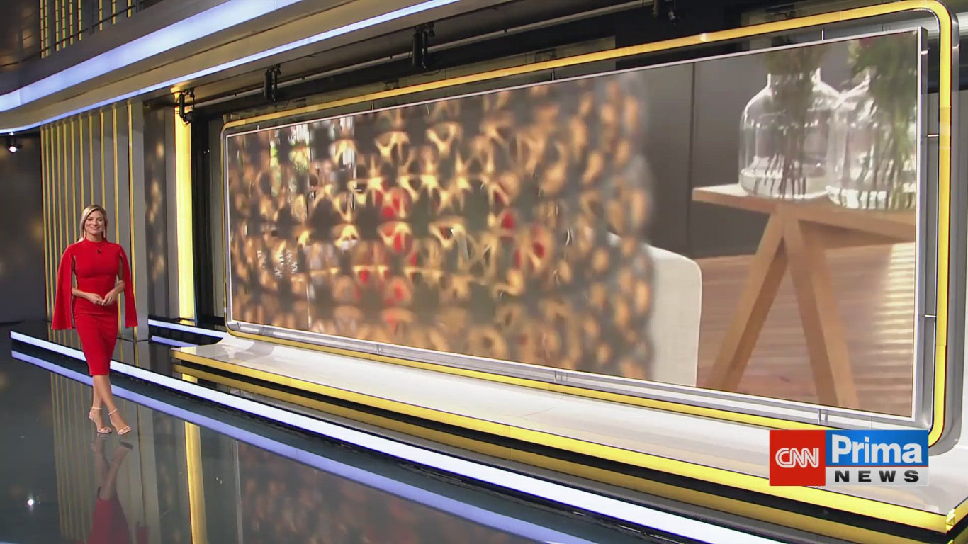 Jana Boušková na muzikoterapii - SHOWTIME - CNN Prima NEWS