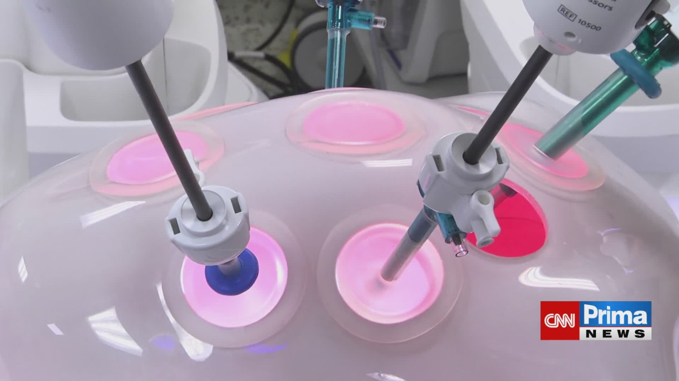 Operační robot - ZPRÁVY Z REGIONŮ - CNN Prima NEWS